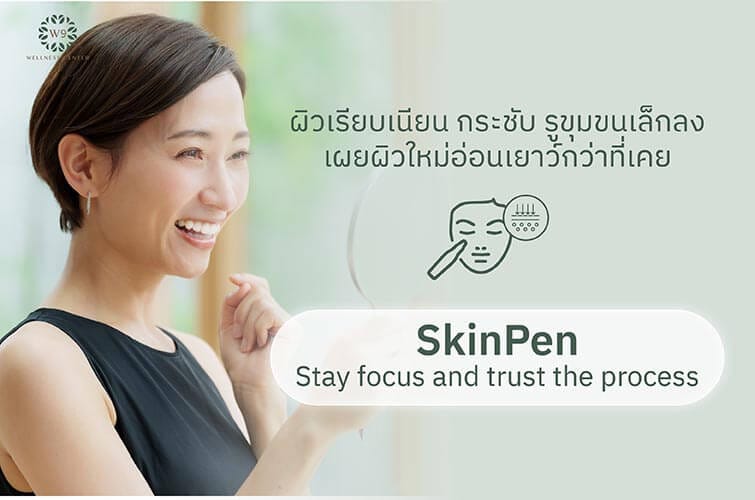 Build confidence for beautiful, clear skin with SkinPen - W9wellness